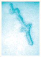 Our Services | Introduction | Plastic Surgery | Asan Medical Center